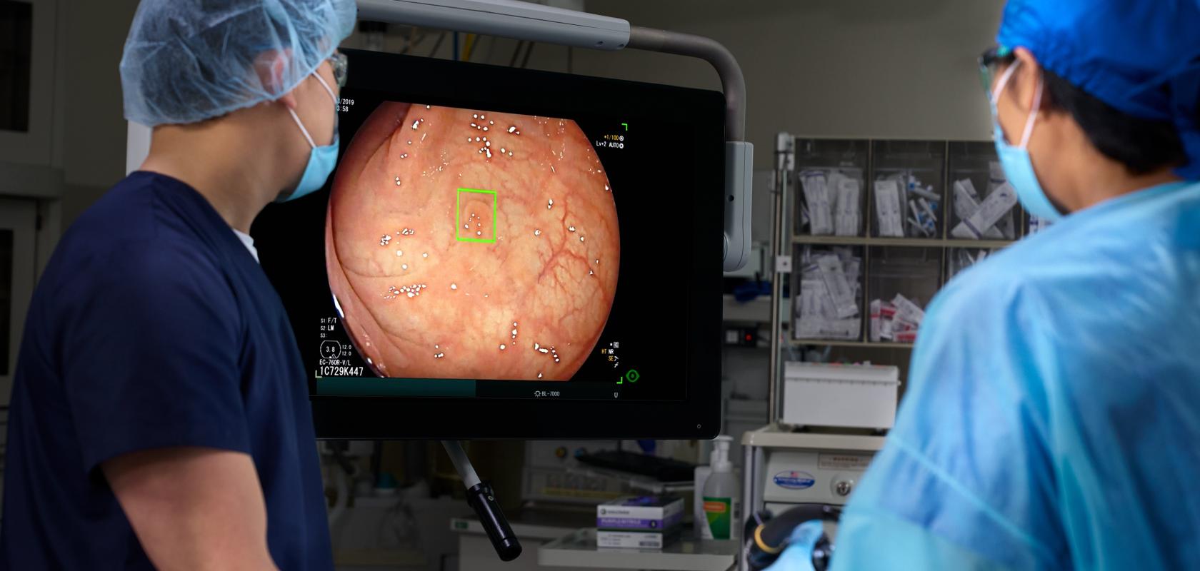 UK hospitals keep AI-endoscopy tech after cancer trial | Imaging and Machine Vision Europe